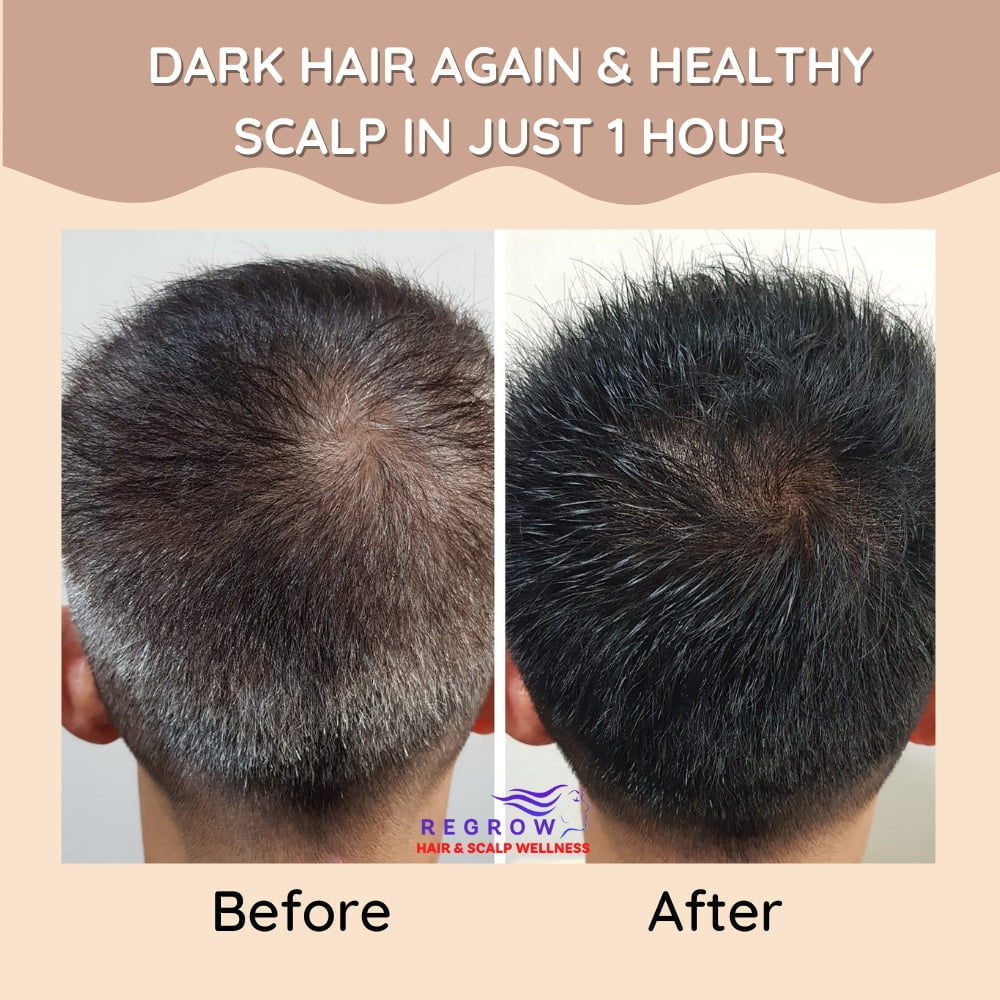 Regrow Herbal Hair Colouring Scalp Treatment Powder 100g FREE Hair Dye ...