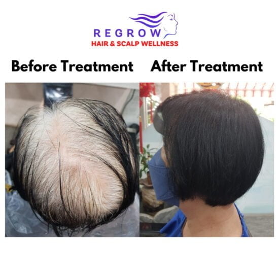 Regrow Herbal Hair Colouring | WOMEN ONLY | Hair Dye + Scalp Treatment ...
